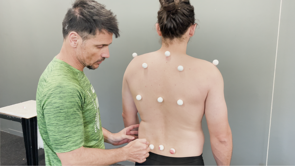 Como fazer avaliação postural pelo método da fotogrametria? - Eksy